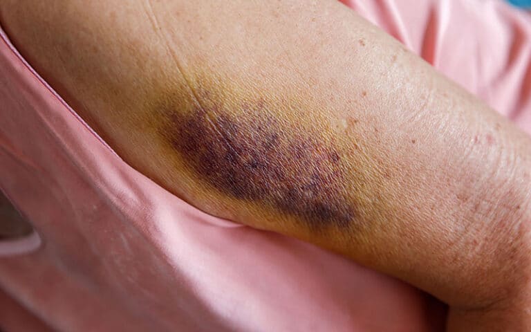 Certified Wound Care | Dignity Home Health & Hospice